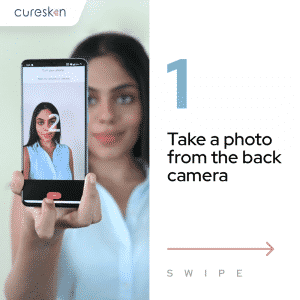 Skin & Hair Treatment Kit Pricing - Cureskin