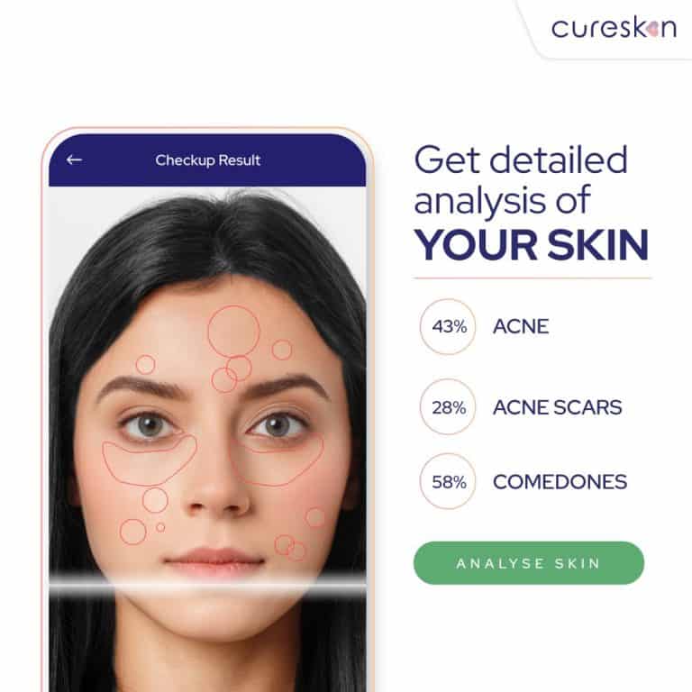 Scan Your Face For Skin Problems Using CureSkin App
